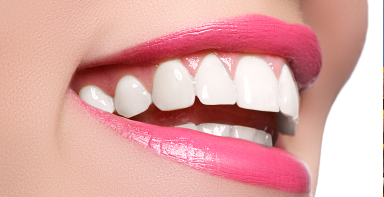 Multiple Root Canals - Burkett Dentistry